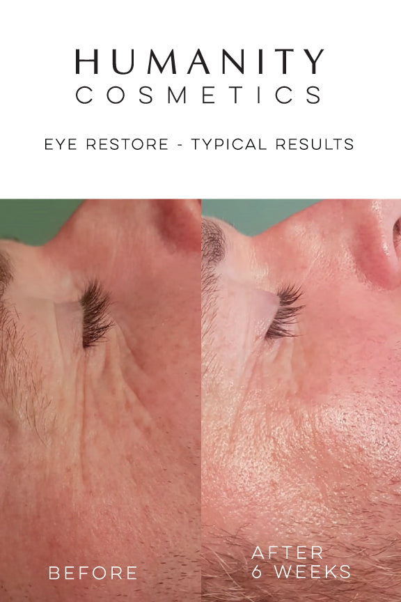 EYE RESTORE KIT – Essentials 4 Men